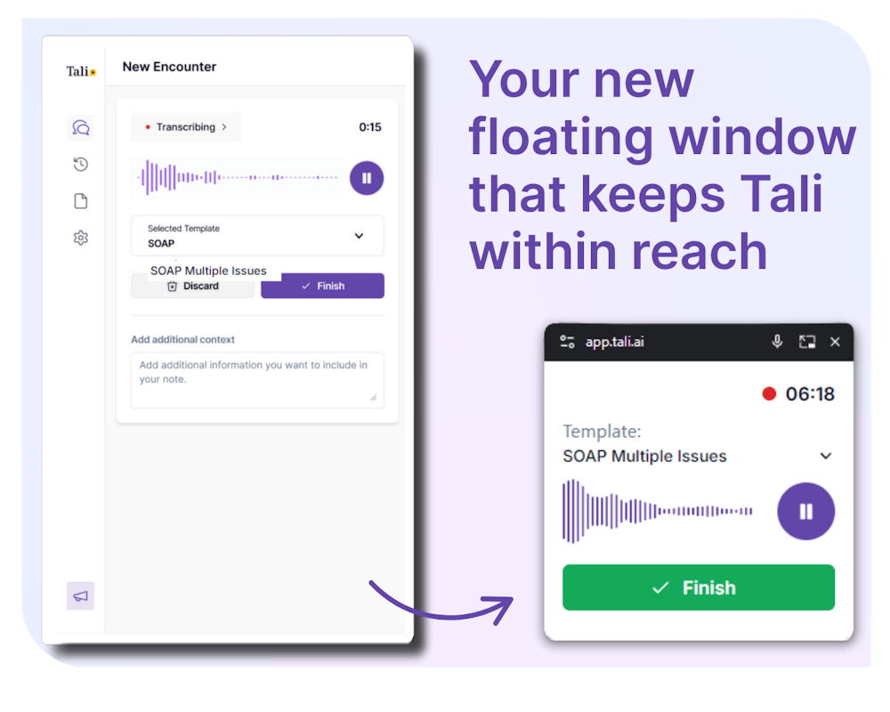 Introducing Tiny Tali: Picture-in-Picture for Smoother Charting